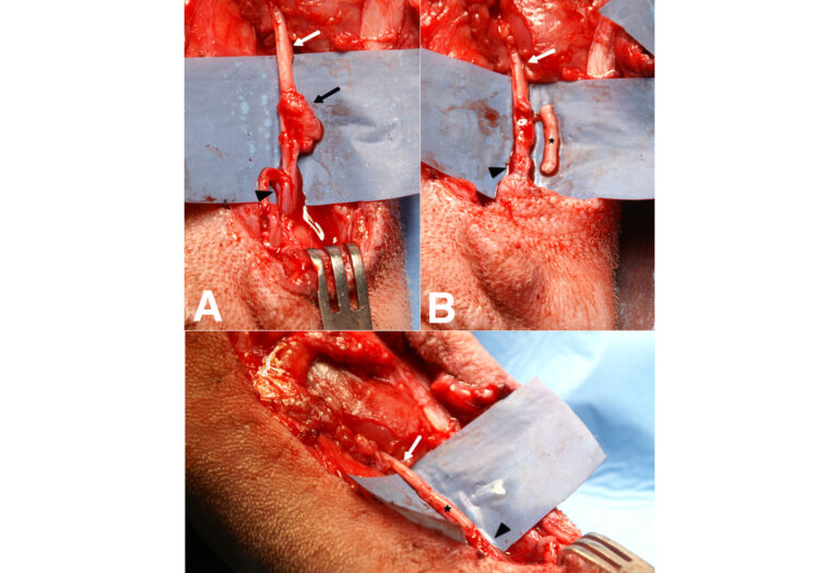 JAAHA Case Report of the Month - Tibial Nerve Neuroma - AAHA